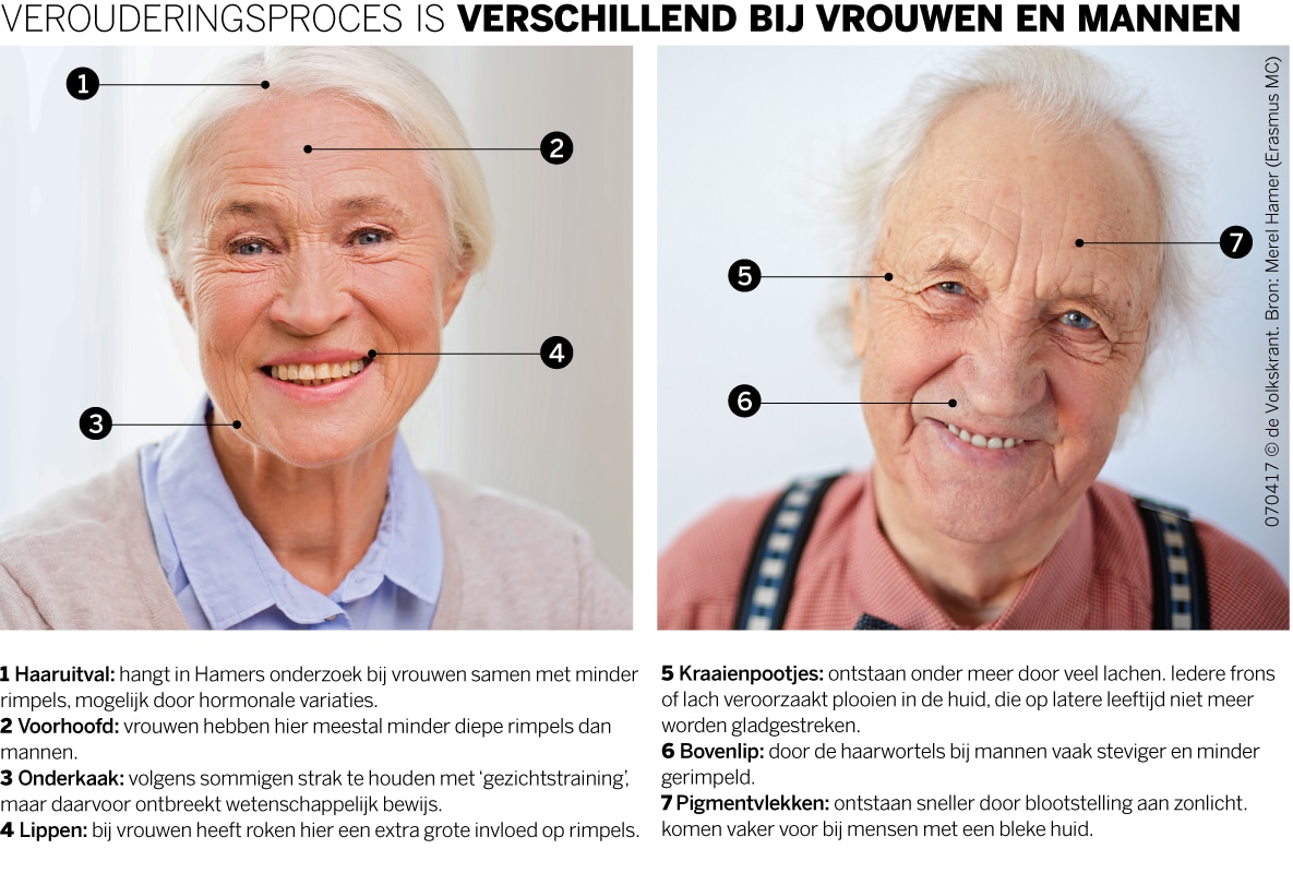 Onderzoek: "Mannen krijgen veel eerder rimpels dan vrouwen" | De Morgen