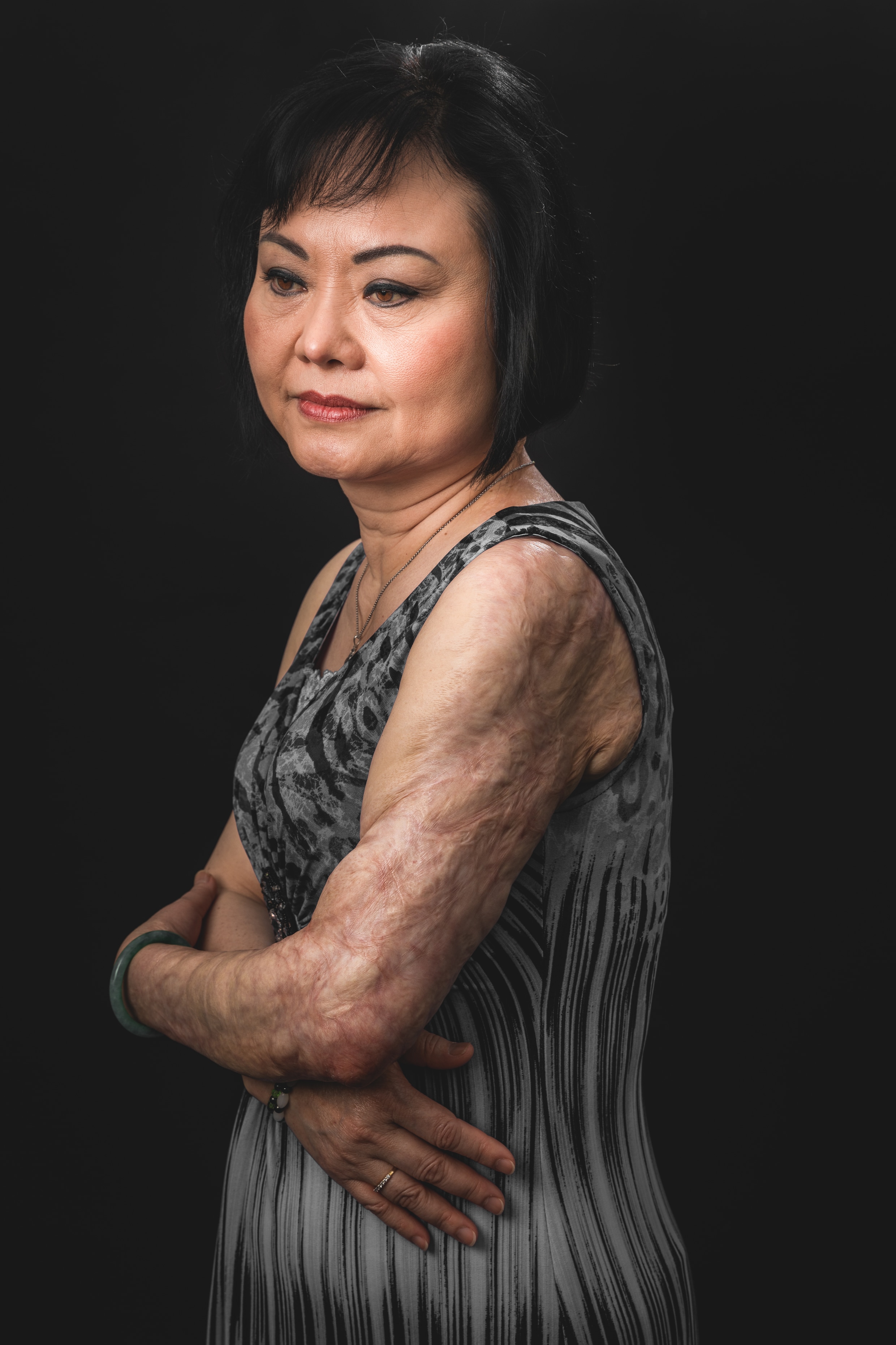 ‘Napalmmeisje’ Phan Thi Kim Phuc ondergaat na 50 jaar laatste huidbehandeling | De Morgen