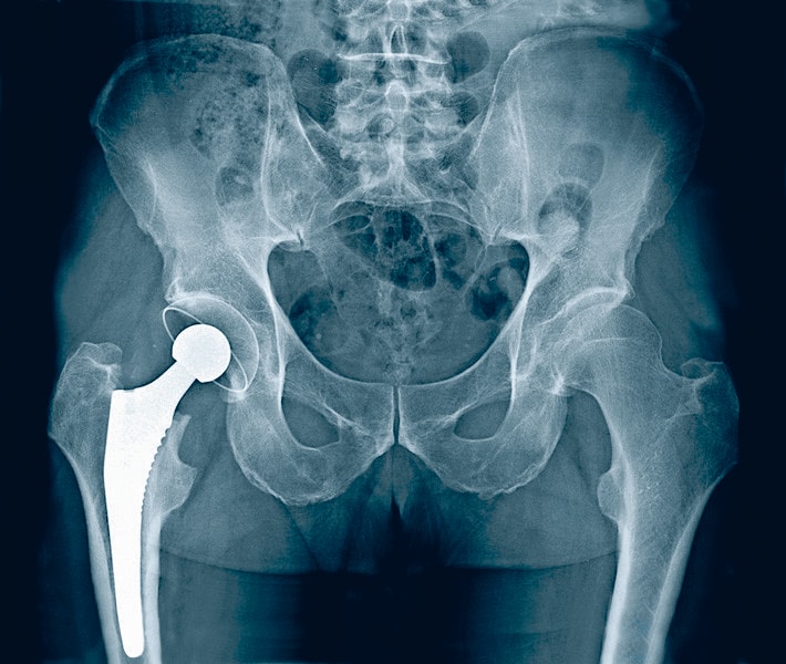 Teylers Museum vindt per toeval origineel setje eerste röntgenfoto’s ...