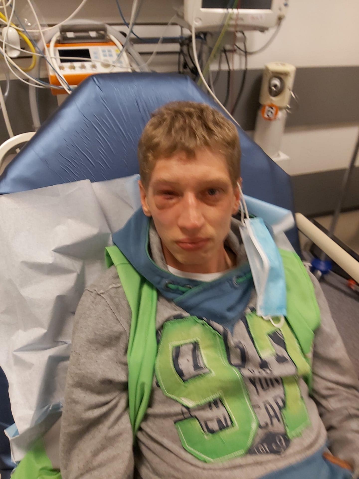 Massale steun voor Kevin (29) na zinloze aanval in park | De Morgen