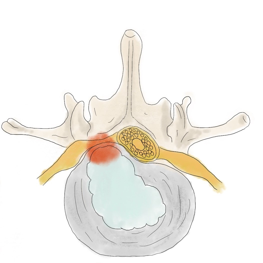 Last van je rug tijdens het telewerken? Experts leggen uit hoe je een ...