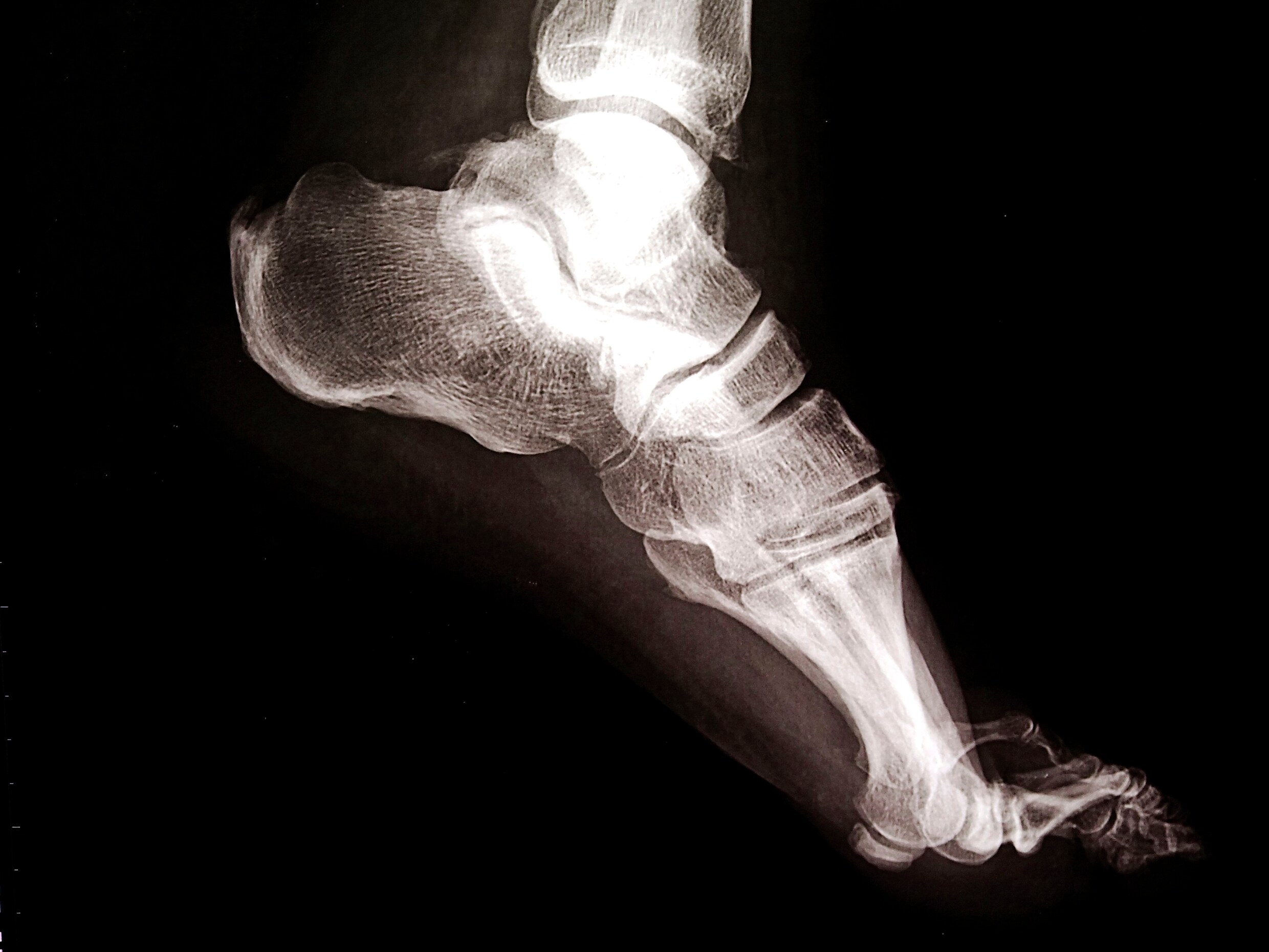 We verwaarlozen massaal onze voeten: ‘Ik haal ruim 90 procent van mijn ...