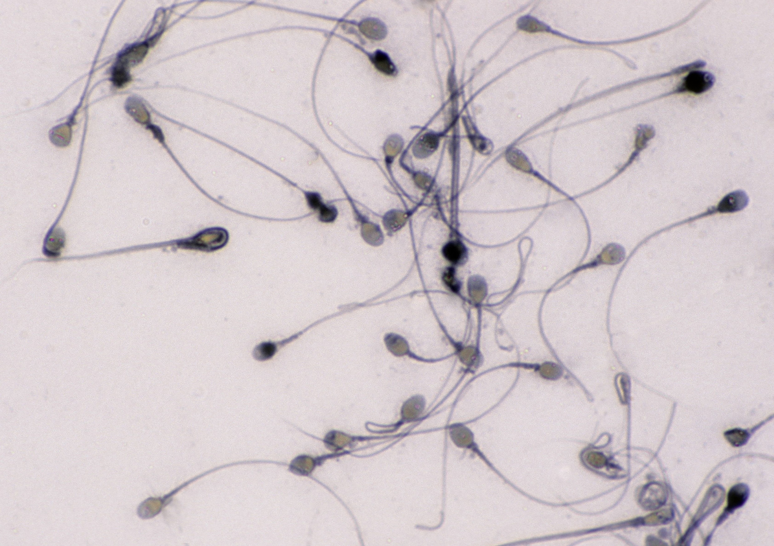 Gaat het echt zó slecht met de spermakwaliteit? ‘Paniek is niet nodig ...