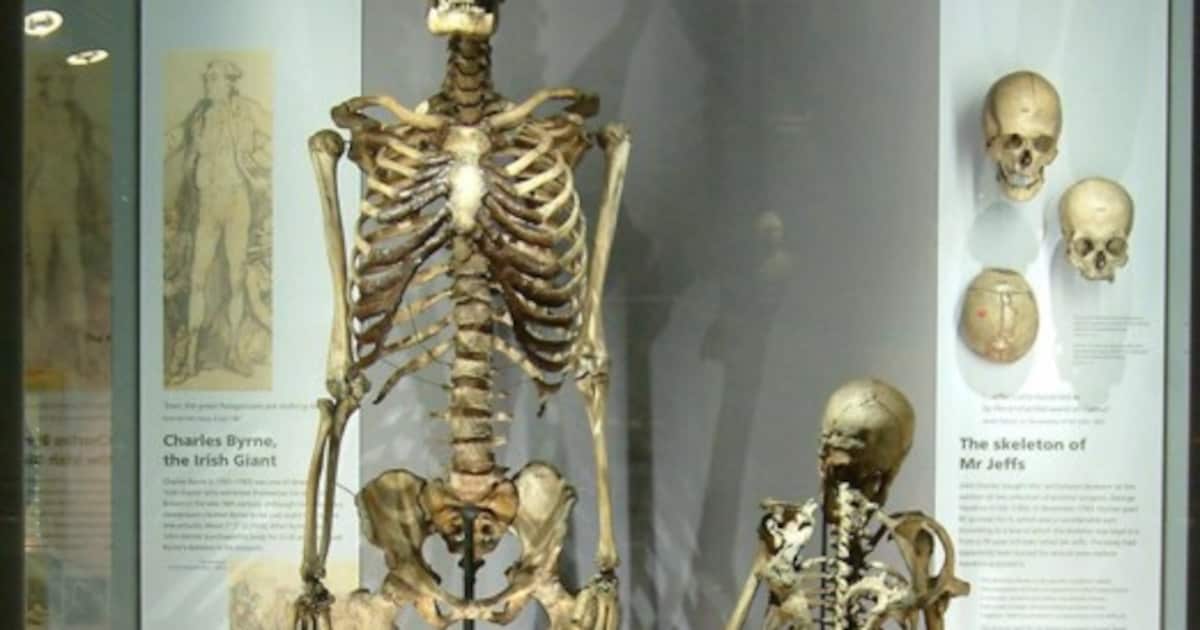 Skelet van ‘Ierse reus’ verdwijnt uit Londens museum wegens ‘ongepast ...