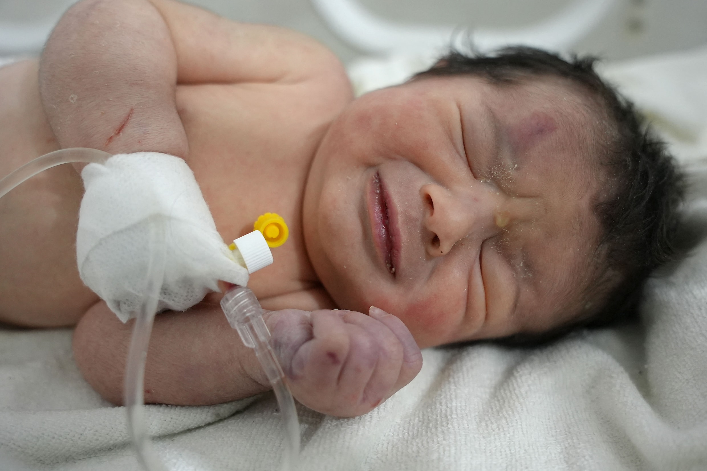 Pasgeboren baby die nog met navelstreng vasthing gered vanonder het ...