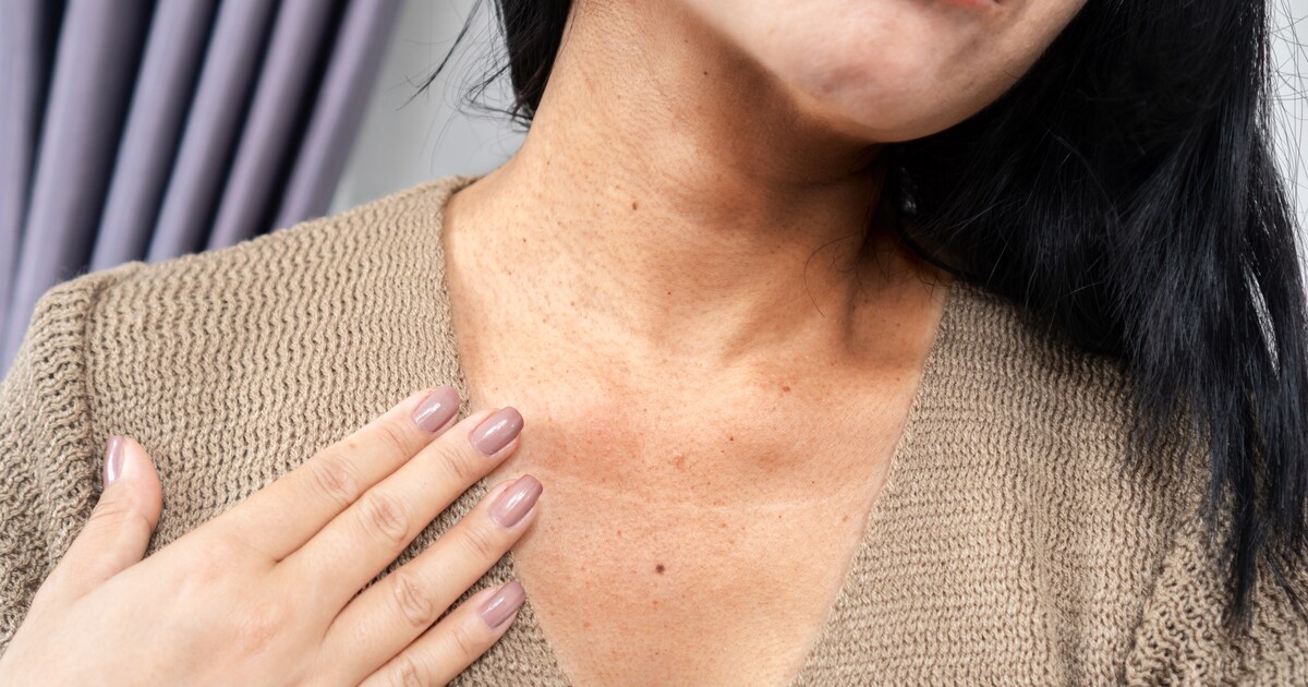 Waarom ziet mijn hals er zoveel ouder uit dan mijn gezicht? | De Morgen