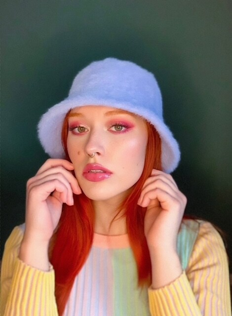 Deze mensen twijfelen over hun (moeder)vlekjes. ‘Ik ging altijd zo ...