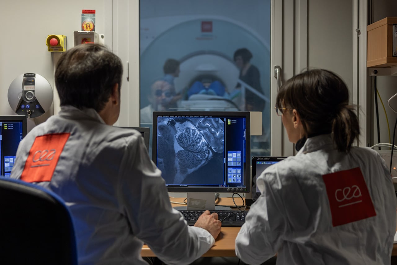 Nieuwe superscanner geeft scherpste MRI-beelden van hersenen ooit ...