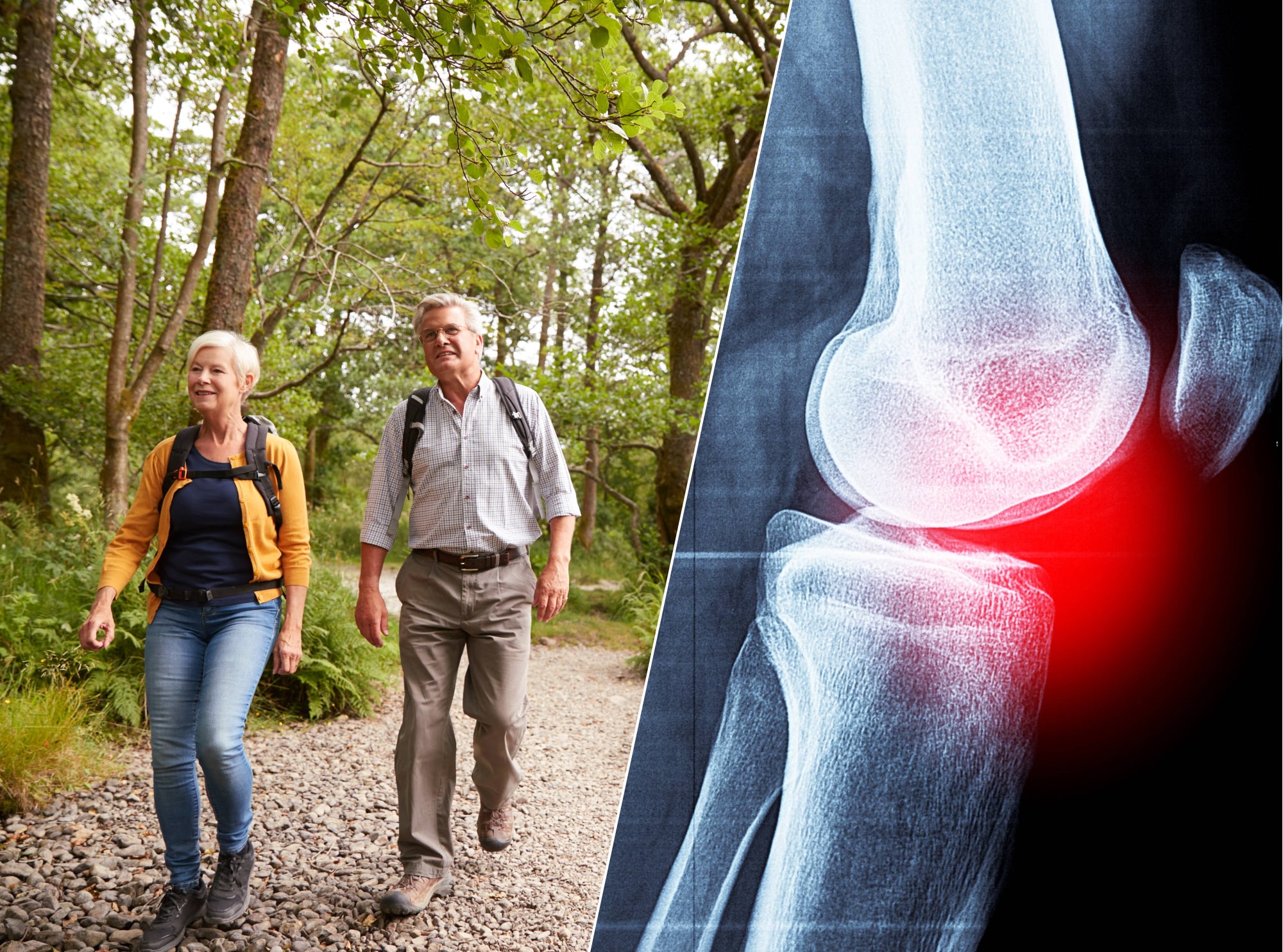 Vooral ouderen krijgen last van broze botten: met deze voeding kun je ...