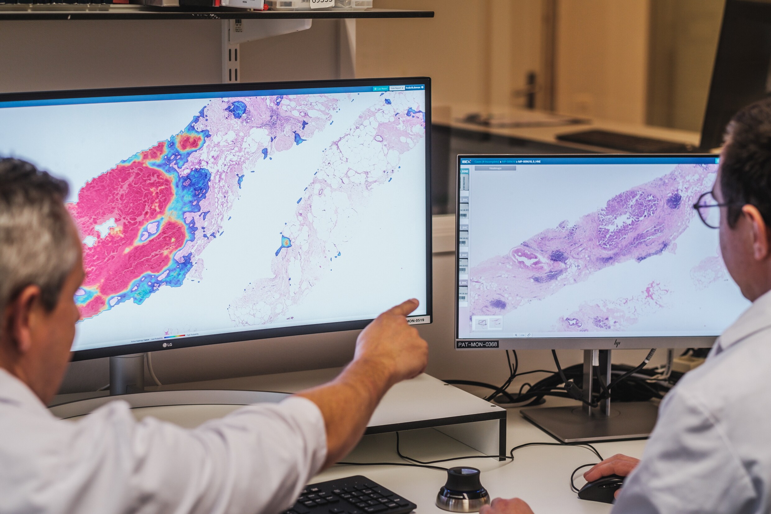 Analyse van tumorstaal verloopt bijna 20 procent sneller dankzij AI in ...