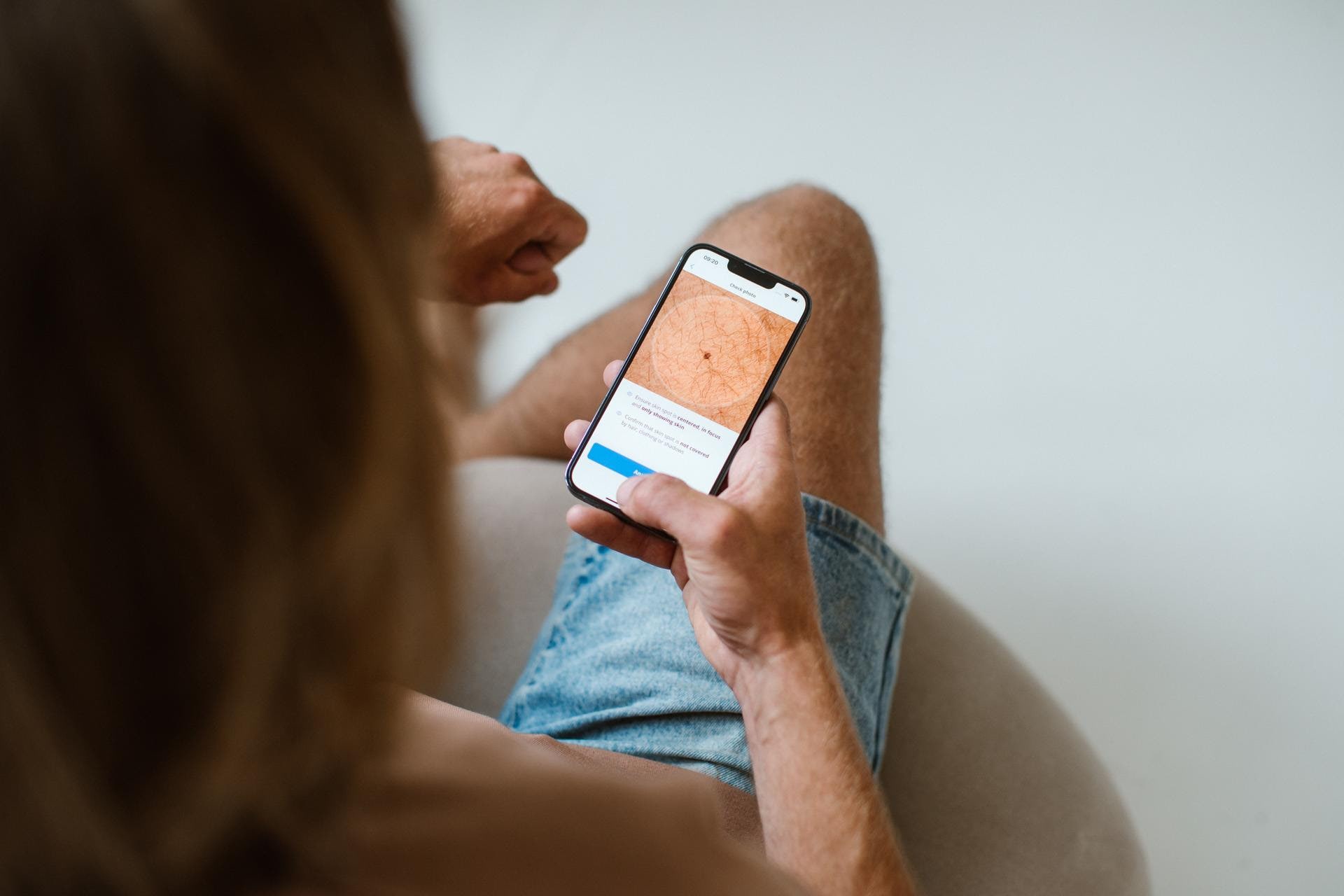 App die vlekjes scant op huidkanker mist een op vier gevallen, blijkt ...