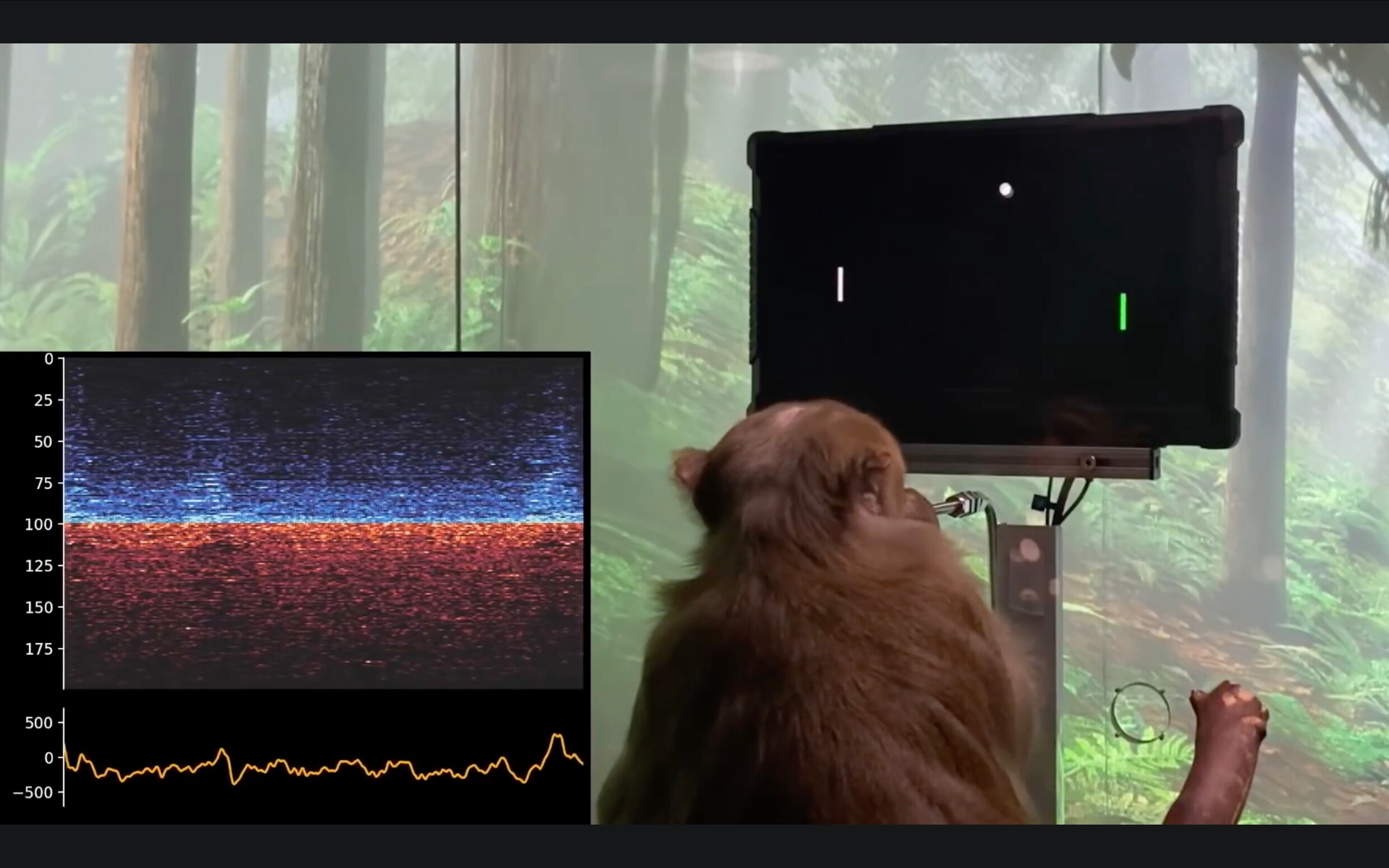 ‘Ik kan een computer besturen met mijn gedachten’: hoe China zich mengt in de race naar ...