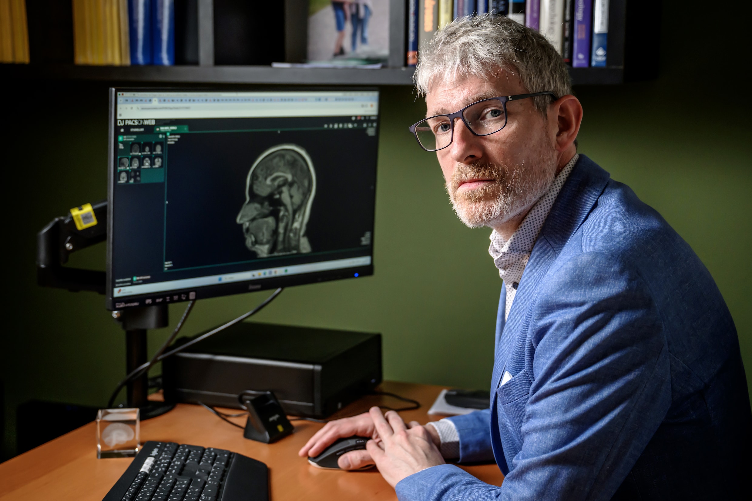 Neuroloog Gert Cypers: ‘Op straat zie ik aan de manier van bewegen ...