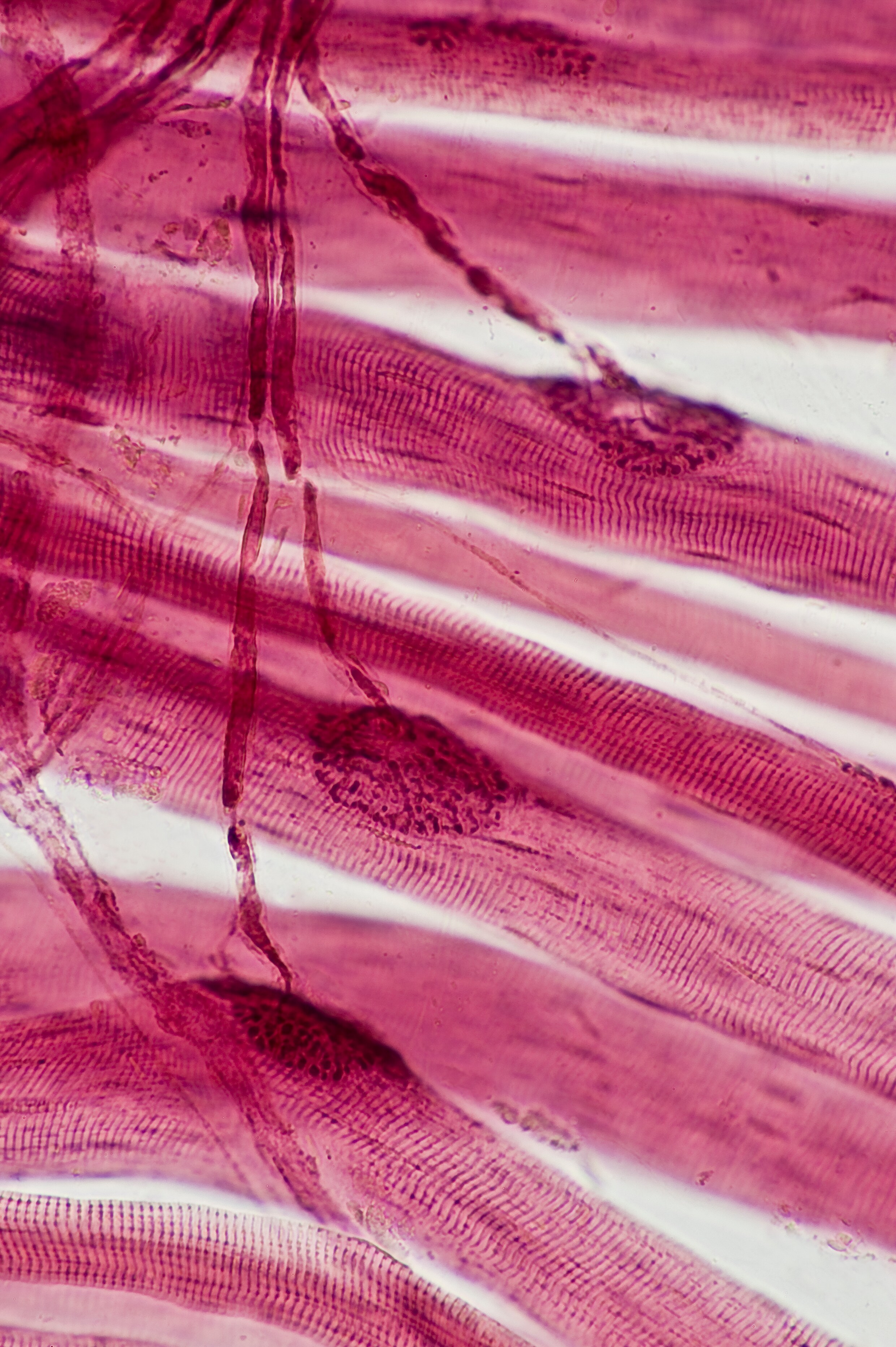 Wie niet beweegt, verliest spierkracht. Maar dat is niet het hele ...