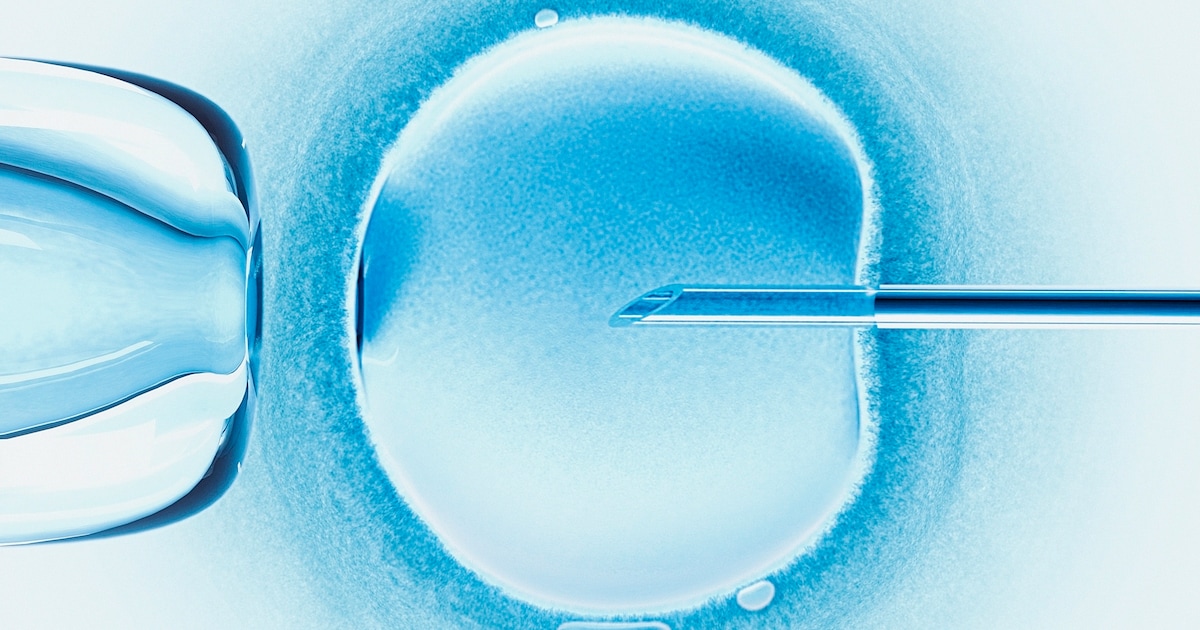 Menselijke eicellen en embryo’s uit huidcellen: kan deze techniek ooit ...