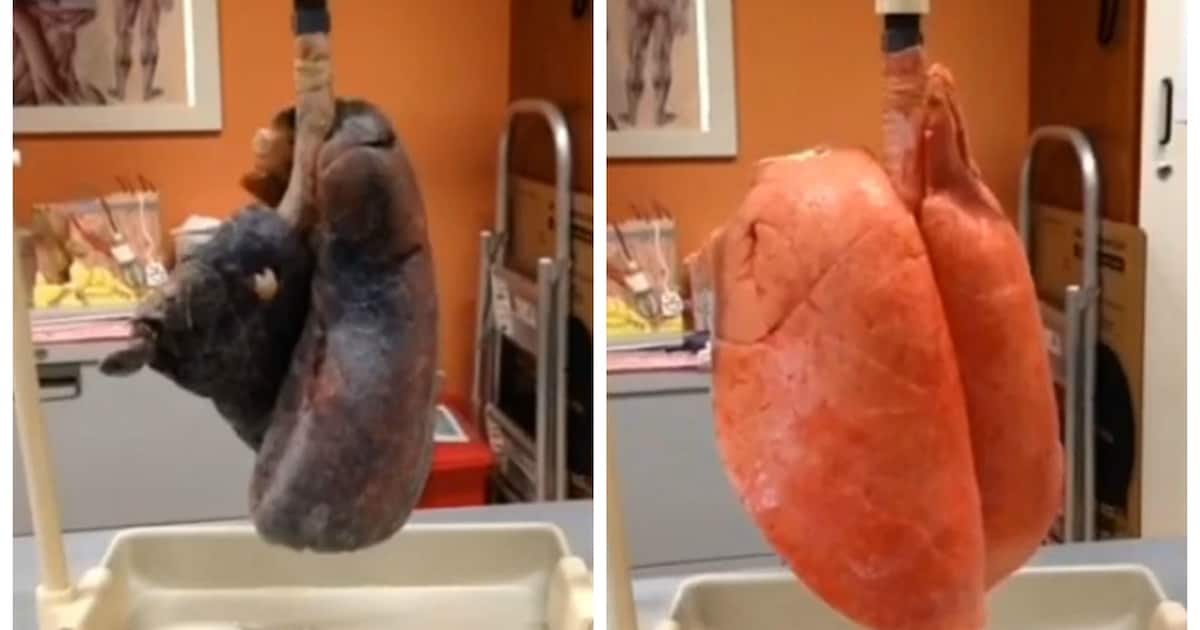 Confronterende beelden van gezonde vs. rokerslong | De Morgen