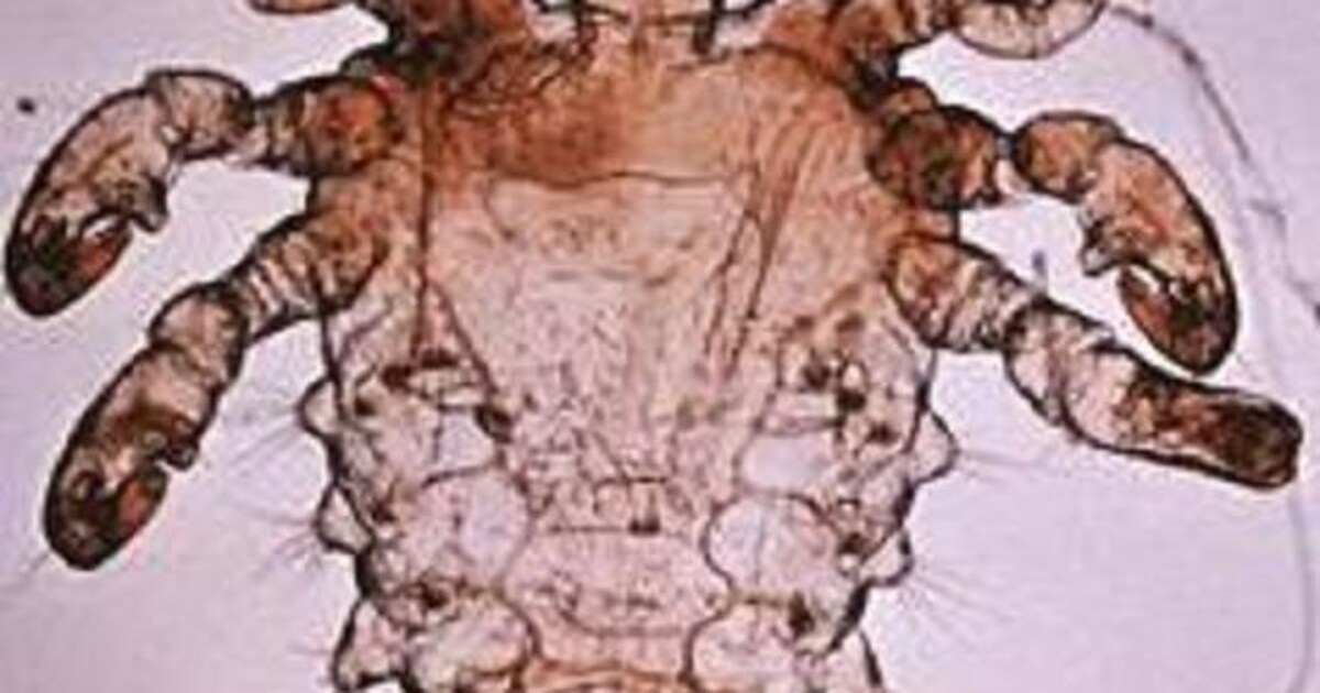 Nederlands museum wil verzameling schaamluizen aanleggen | De Morgen