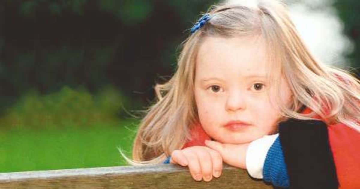 Ouders kiezen voor plastische chirurgie voor mongooltje | De Morgen