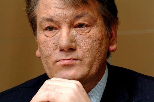 "Joesjtsjenko was niet vergiftigd met dioxine" | De Morgen