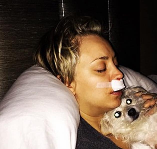 Kaley Cuoco herstelt van operatie | De Morgen