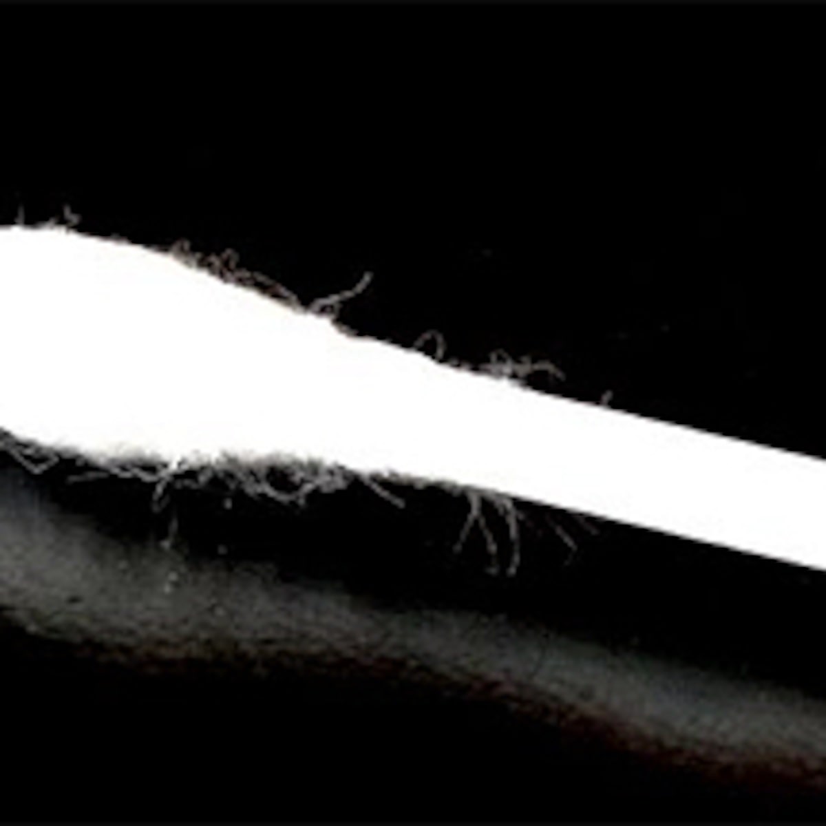 Stafylokok Infectie In De Neus Stafylococcus Scalded Skin Syndroom