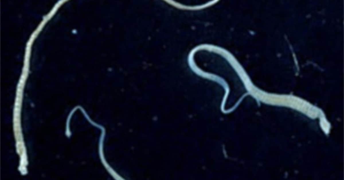 Man sterft nadat lintworm in zijn long kanker kreeg | De Morgen