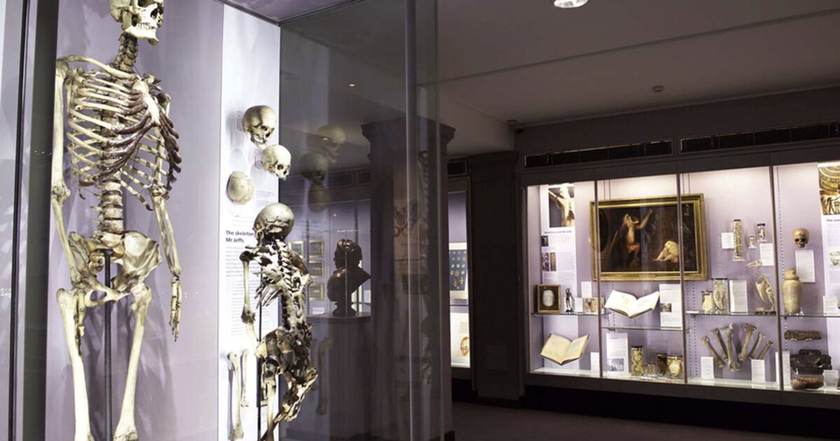 ‘Ierse reus’ die nooit tentoon wilde staan vindt na 200 jaar eindelijk ...