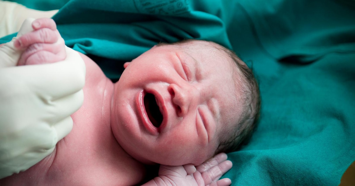 Succes van keizersnede zorgt voor grotere babyschedels | De Morgen